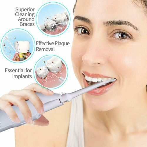 Power Floss Air Powered Dental Water Jet – PKEmart